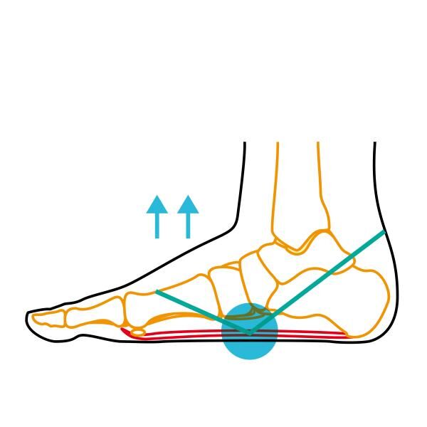 COMPRESSANA TAPE SOX Knick-Senkfuß Pronation control Sport, verhindert ...